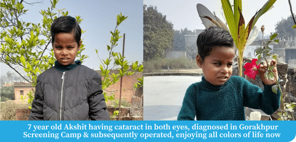 Department Of Cataract - Dr. Shroff's Charity Eye Hospital